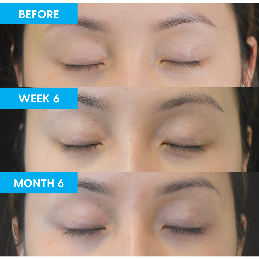 Life After Lash Extensions: 6 month update